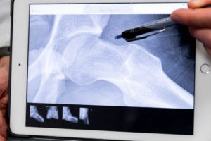Meet Scott Wingerter, MD, PhD - Orthopedic Surgeon in Kansas City